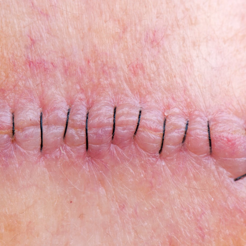 Protecting your skin from the sun | Medicus Pharmacy