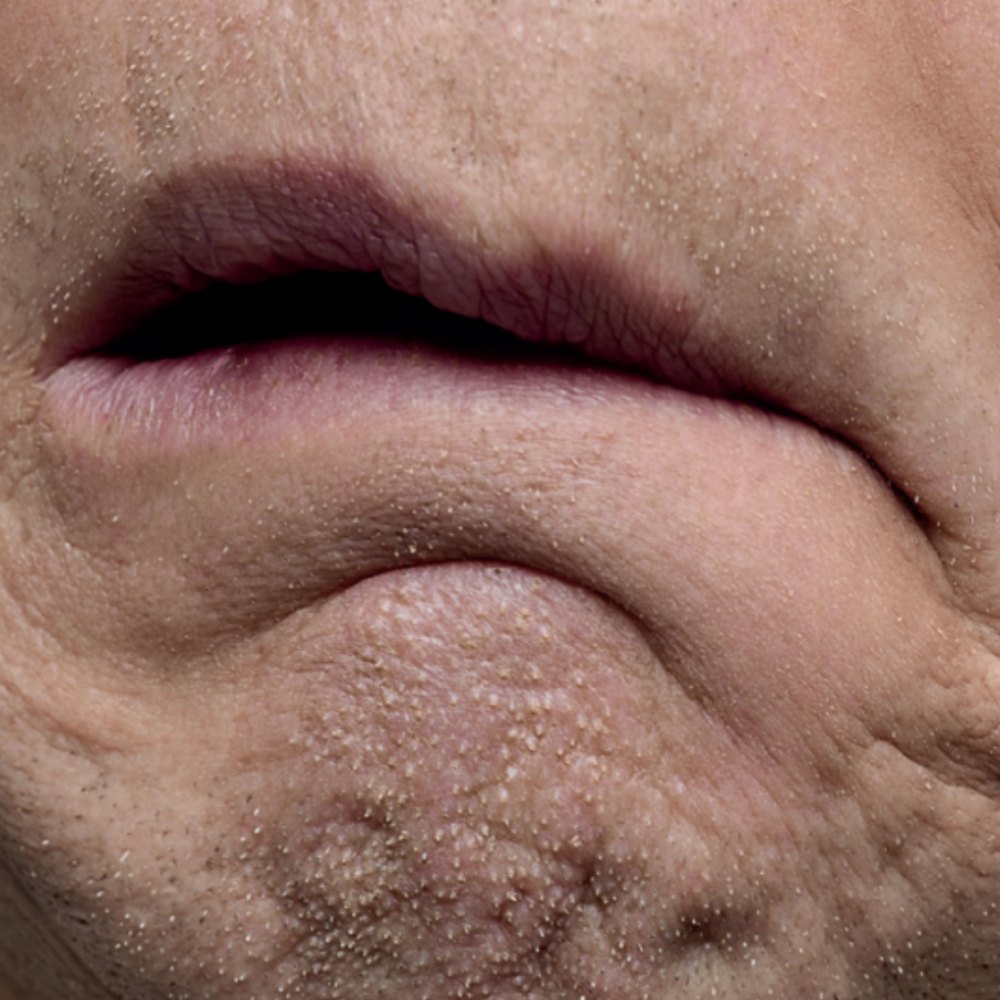 When a stroke strikes, act f.a.s.t | Medicus Pharmacy